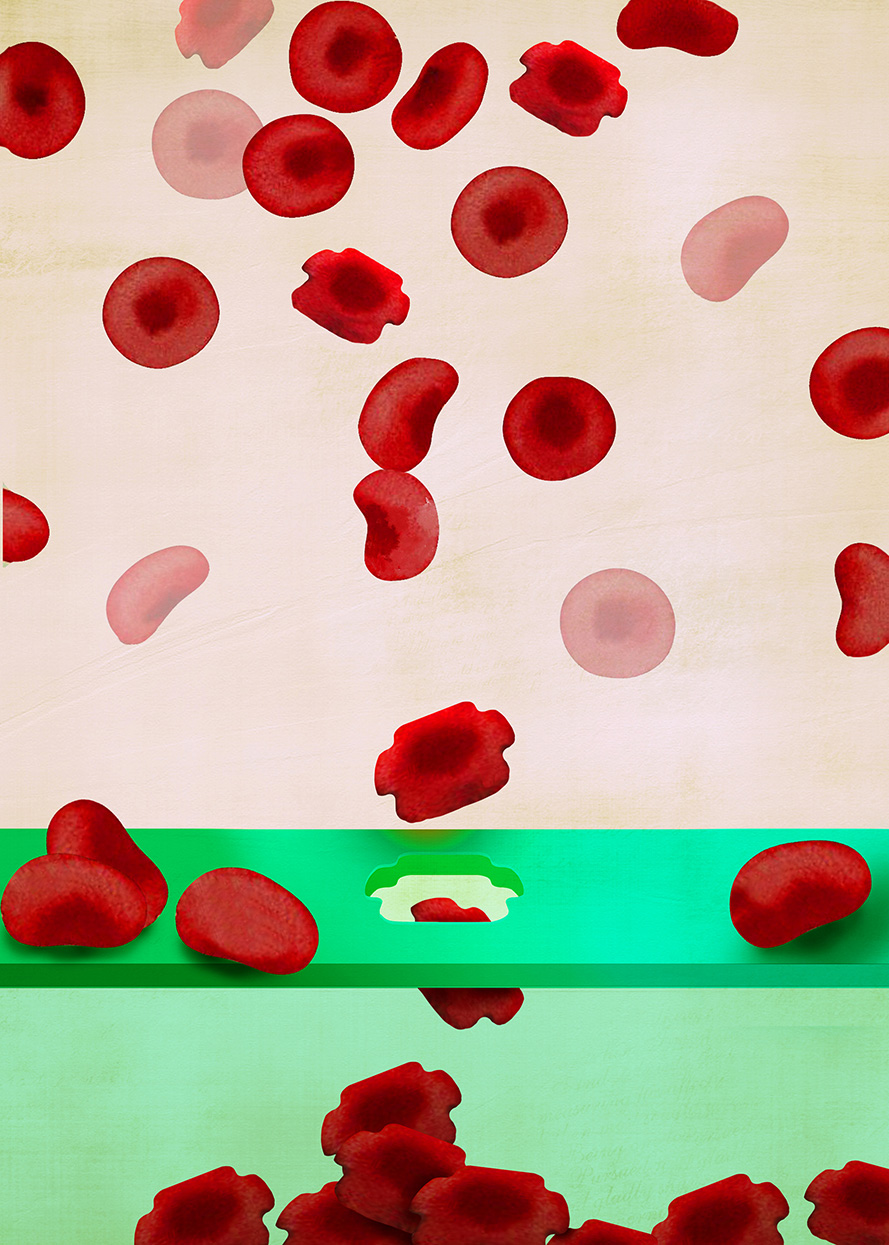 The shape of malaria